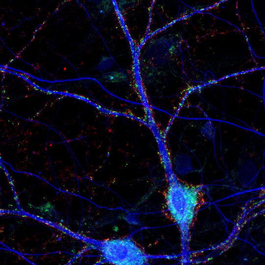 Tips for Keeping Primary Neuron Cultures Healthy – DendroTEK ...